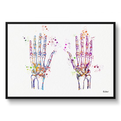 Hand Bones Anatomy Watercolour Print Hand Surgeon Medical Doctor Office ...